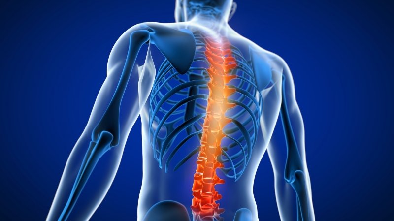 Όγκοι σπονδυλικής στήλης και νωτιαίου μυελού - neyroxeirourgos.gr